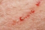Why Do Cat Scratches Sting and Hurt So Much - The Kitty Expert